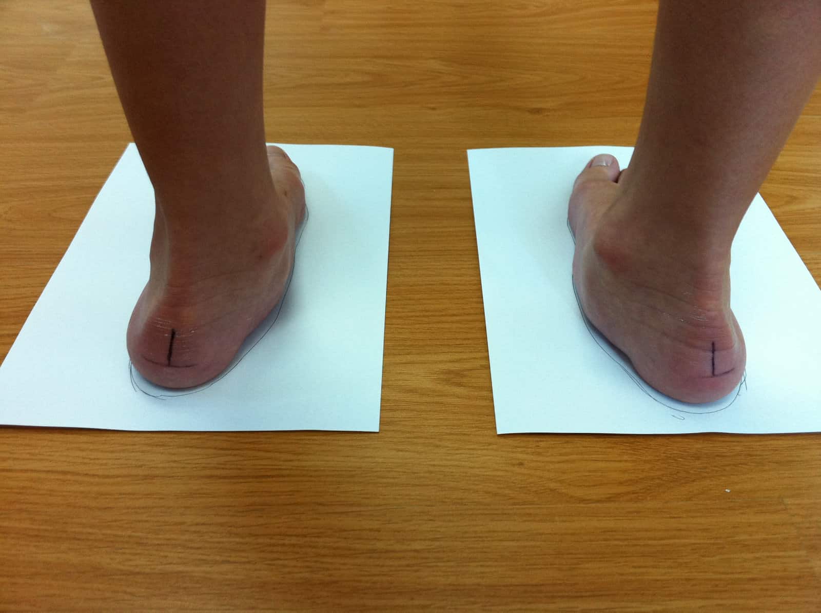 Understanding Growing Pains in Children | My Foot Dr