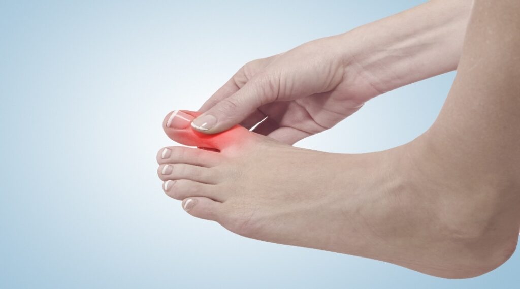 What Is Turf Toe? Symptoms, Causes, and Recovery Tips