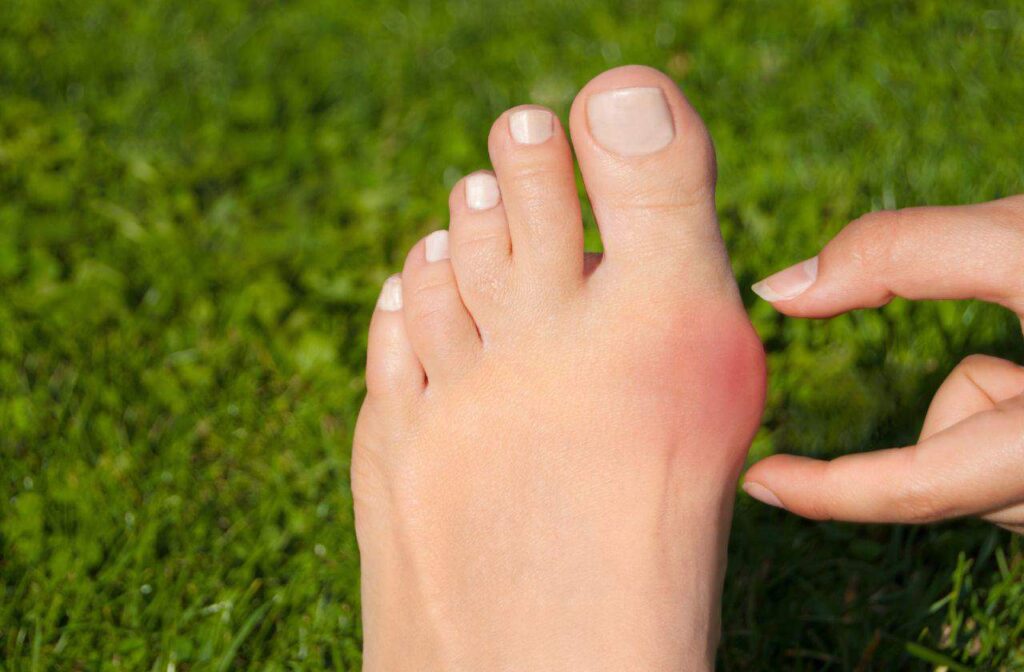 What Is Turf Toe? Symptoms, Causes, and Recovery Tips